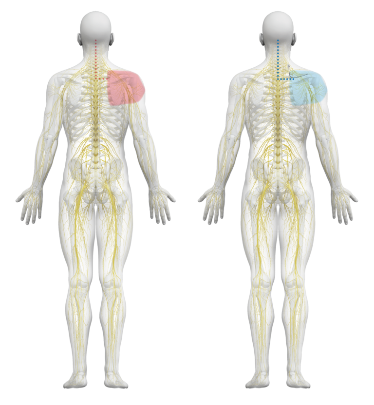 Peripheral Nerve Stimulator | Nalu Medical